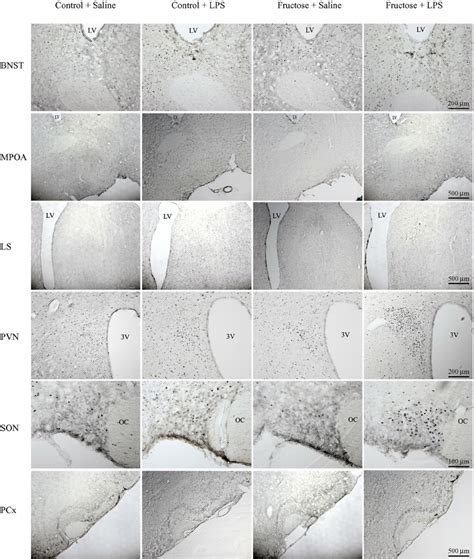 Representative Photomicrographs Showing The Immunoreactivity Of C Fos