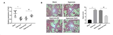 Long Non Coding Rna Lncrna Taurine Upregulated Gene 1 Tug1 Is
