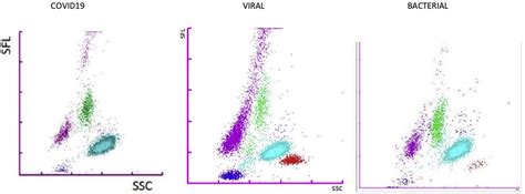 Utility Of Differential White Cell Count And Cell Population Data For