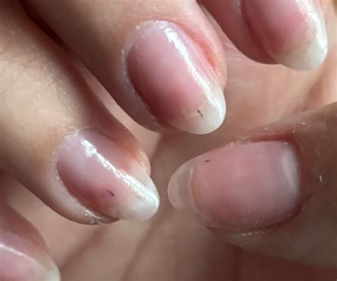 손톱에 검은 지식in