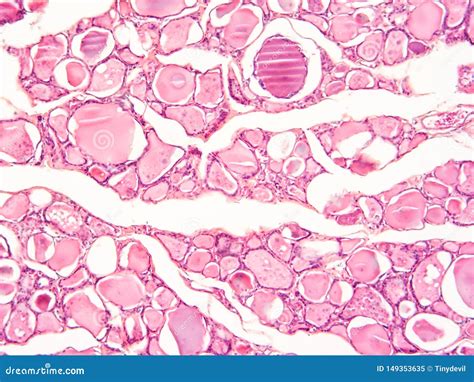 Histology Of Human Thyroid Gland Tissue Stock Image Image Of Thyroid