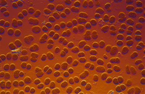 Eucapsis Dic Photograph By Michael Abbey Pixels