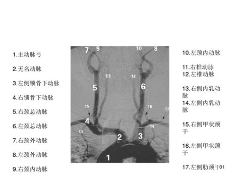 全脑血管造影术ppt课件word文档在线阅读与下载无忧文档
