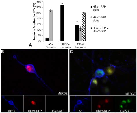 Co Infection Of Dissociated Adult Trigeminal Neurons In Vitro