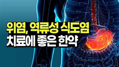 위염 역류성 식도염 한약으로 치료가 가능할까요 Youtube