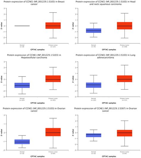 Pan Cancer Analysis Identifies The Oncogenic Role Of Ccne1 In Human