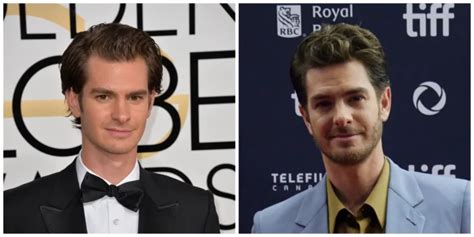 Andrew Garfield Hair Transplant Longevita