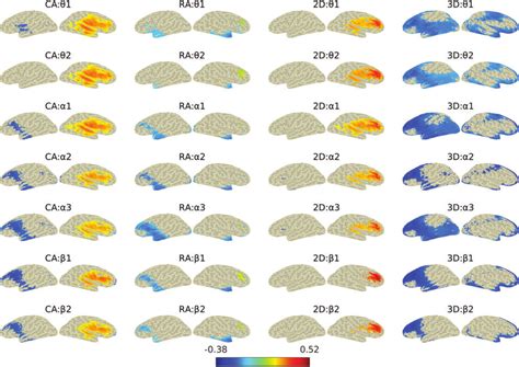 Neural Activities For The Four Gaming Groups During The Computer Game Download Scientific