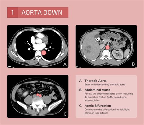 Differential Diagnosis Of Infographic Ct Abdomenpelvis Interpretation