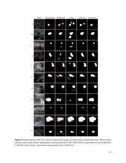 Attention Enriched Deep Learning Model For Breast Tumor Segmentation In Ultrasound Images Deepai