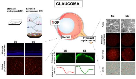 Effect Of The Enriched Environment Ee On Experimental Glaucoma