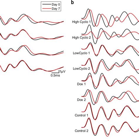 Example Of Abr Waveforms Stacked By Sound Level With Peaks And Troughs