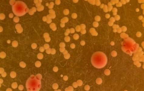 Klebsiella Pneumoniae Microscope