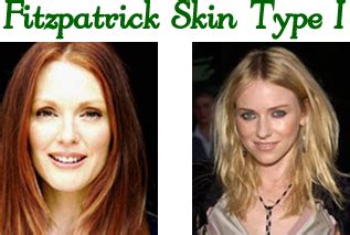 Fitzpatrick Skin Type 1 Sinclair Aesthetics Clinic Edenvale