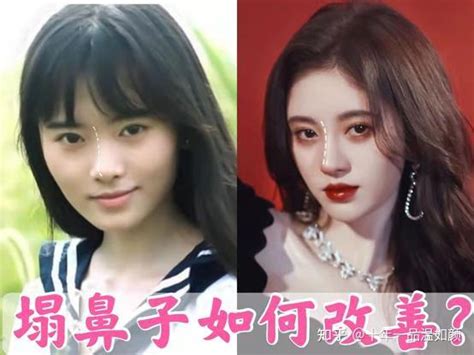 塌鼻子的小鞠是如何变挺的，同是塌鼻梁的你如何改善 知乎