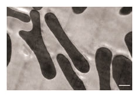 Images Obtained By Transmission Electron Microscopy For Rbcs At Download Scientific Diagram