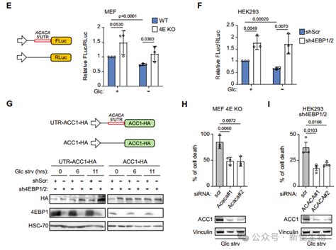 Nc 翻译重编程脂肪酸代谢，在饥饿条件下调控细胞存活 生物学堂 新使生物公司官网 让核糖体印迹分析变得更简单