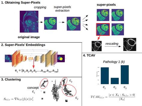 Interpretability Of A Deep Learning Model In The Application Of Cardiac Mri Segmentation With An