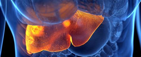 A Single Adjustment To Just One Meal Can Benefit Liver Disease Patients Sciencealert