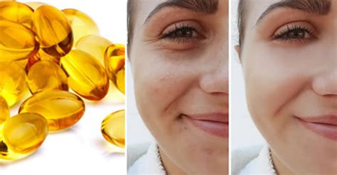 Come Eliminare Le Rughe Con La Vitamina E