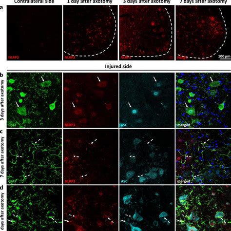 Cellular Localization Of Inflammasome Components After Sciatic Nerve Download Scientific