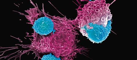 Un camp de margarides TERAPIA CAR T en sus manos la curación del cáncer