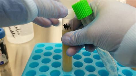Microbiology Fecal Concentration Technique Part 1 Youtube