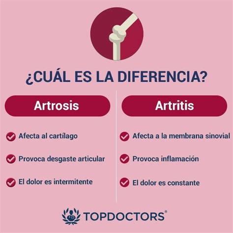 Diferencias Entre Artrosis Y Artritis Artritis Artritis Reumatoide