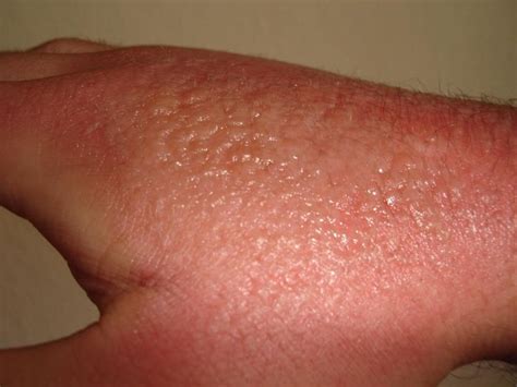 The Skin On Someone S Left Hand Is Brown