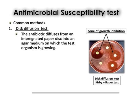 Antimicrobial Susceptibility Testing An Overview Of