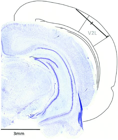 Representative Recording Penetration In The Lateral Extrastriate Download Scientific Diagram