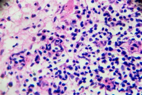 Improving Diagnostic Accuracy The Emergence Of Advanced Microscopy