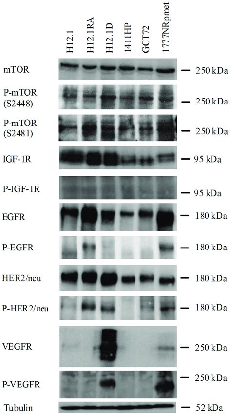 Expression And Phosphorylation Of Egfr Her2neu Vegfr Igf 1r And