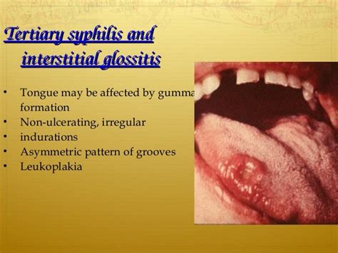 Tongue Ppt