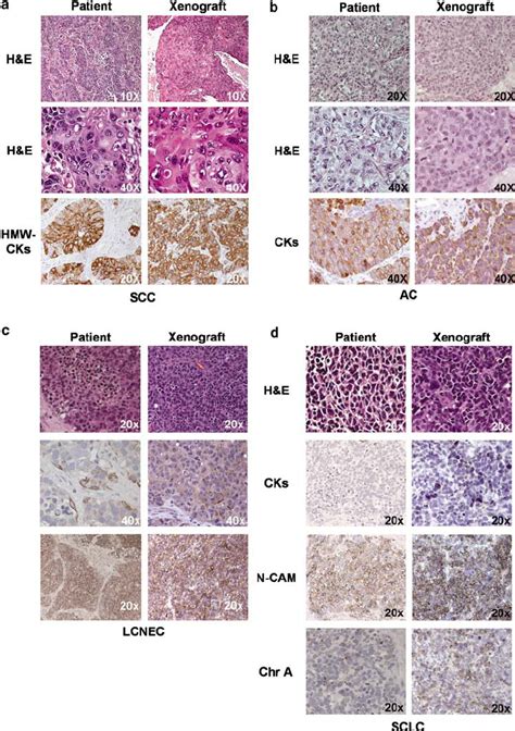 Scc A Ac B Lcnec C And Sclc D Spheres Are Tumorigenic Download Scientific