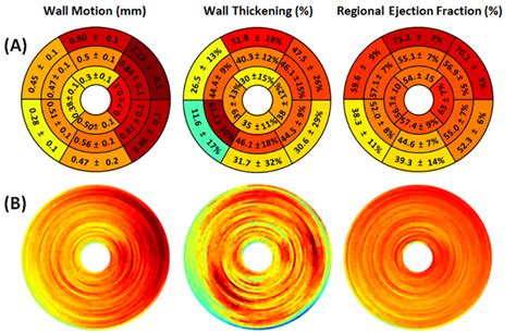 In Vivo Quantitative Assessment Of Myocardial Structure Function Perfusion And Viability Using