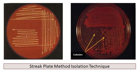 Streak Plate Method A Comprehensive Guide Pharmajia Streak Plate Method A Comprehensive Guide Pharmajia