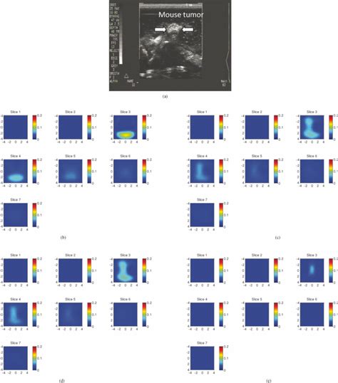 Artifact Reduction Method In Ultrasound Guided Diffuse Optical Tomography Using Exogenous