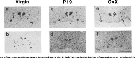 Figure 3 From Regulation Of Neuronal Oxytocin Mrna By Ovarian Steroids In The Mature And