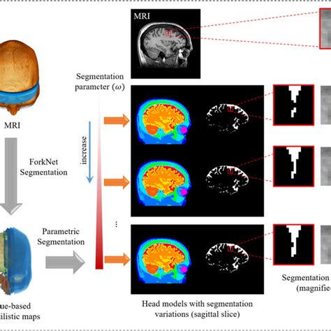 Personalized Head Model Is Generated Through Automatic Segmentation Download Scientific Diagram
