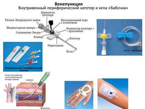 Операции на сосудах Сосудистый шов виды инструменты для операций на