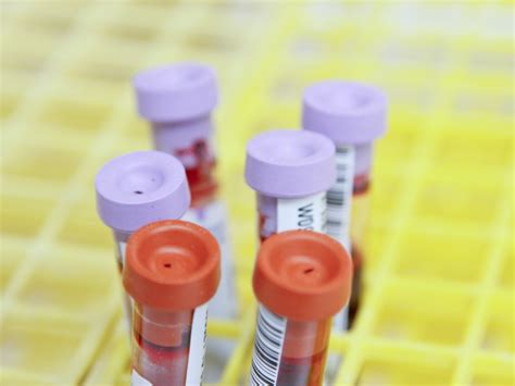 What Is Thc Cooh Blog Jointcommerce