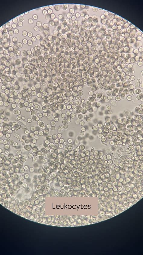 Xətayə M Quliyeva Microbiologist Md Enterococcus Faecium Isolated Urine Culture🧫