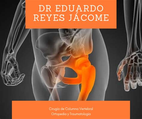 Necrosis Avascular De La Cadera Archivos Cirugia De Columna En Matamoros