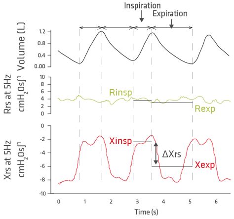Oscillometry How It Works And What Can Measure Restech