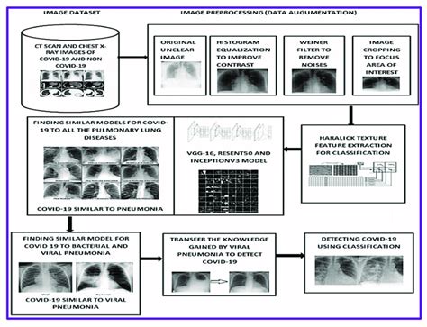 Transfer Learning From Pneumonia Classification Models To Detect Download Scientific Diagram