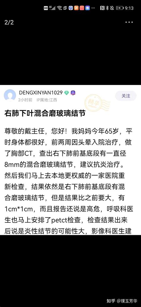 初次发现磨玻璃结节不能太慌，按指南随访三个月排除炎症不耽误 知乎