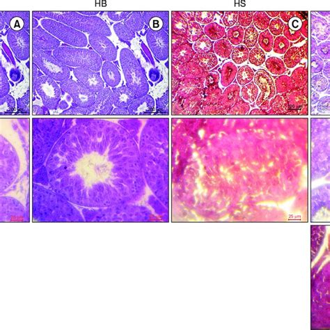 Hande Staining Of Testis Tissue From Heat Stress Treated Male Mice A