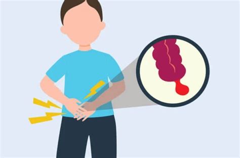 درباره آپاندیس و بیماری آپاندیسیت چه میدانید تابناک TABNAK