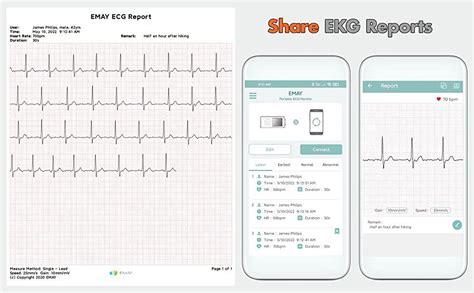 Emay Ekg Monitoring Device Portable Ekg Monitor Works Independently